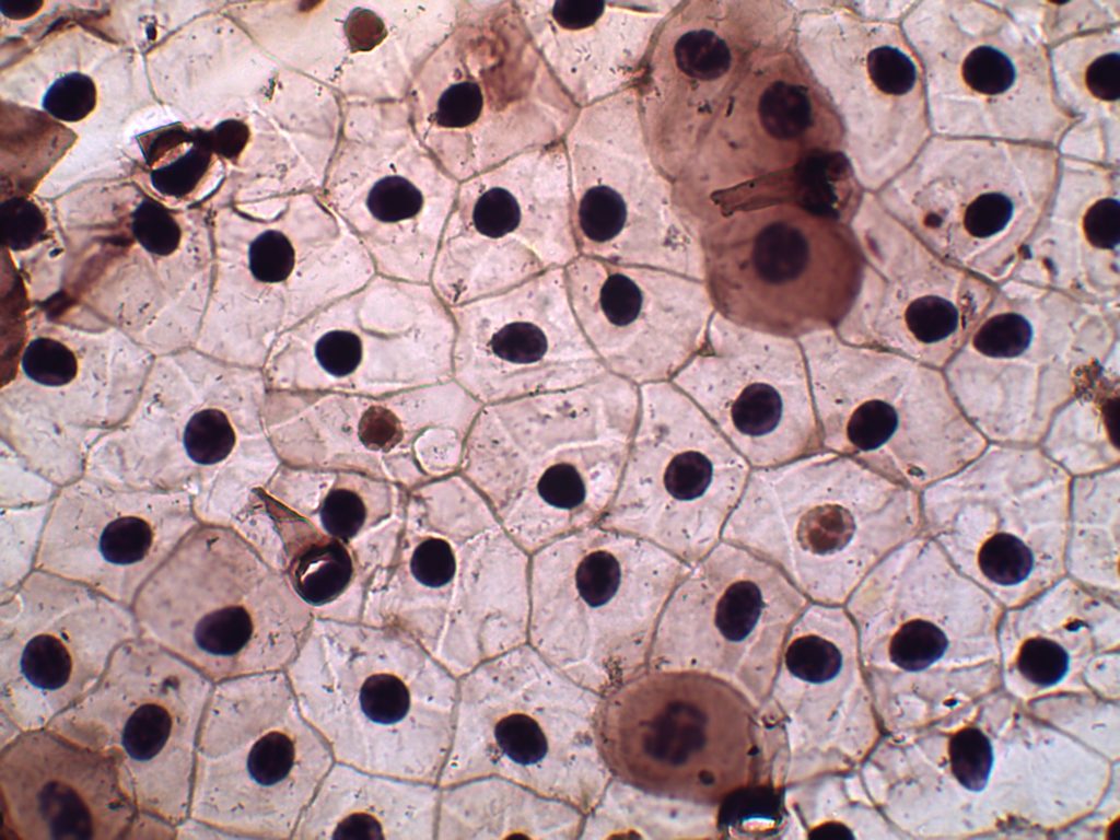 Mesurer un objet microscopique en utilisant Mesurim2 – Sciences de la ...